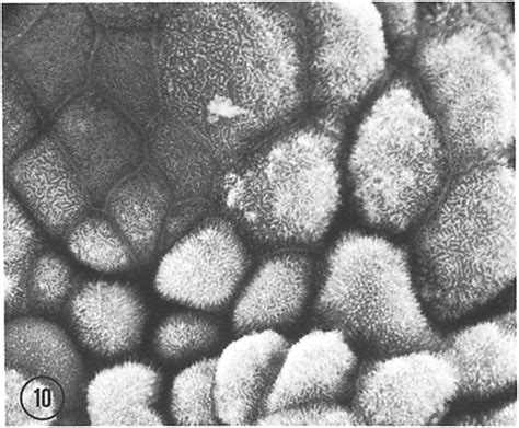 Mucosal Surface Of The Toad Urinary Bladder Fixed After A 30 Min Download Scientific Diagram
