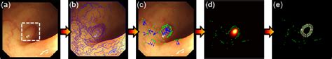 Our Polyp Detection System Given A Test Image A The Input Image With