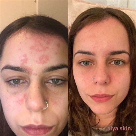 Маска с австралийска розова глина Emag Bg