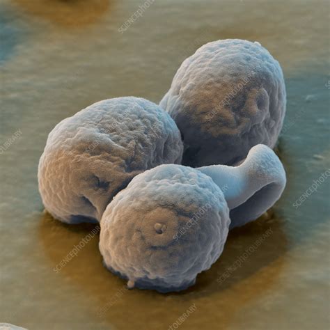 Rye Pollen Sem Stock Image B7860748 Science Photo Library