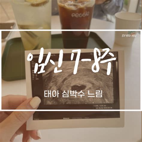 임신 7주 8주 아기 심박수 느림 계류유산 소파술 네이버 블로그