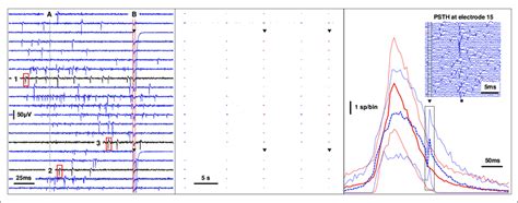 Real Time Feedback Stimulation Contingent Upon The Spatiotemporal Download Scientific Diagram