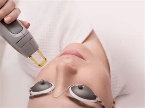 Reclaim Your Confidence With Laser Treatment For Acne Scars