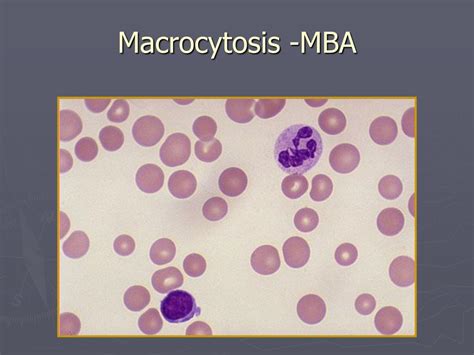 PPT CBC Interpretations PowerPoint Presentation Free Download ID