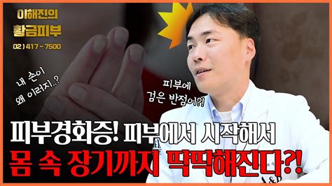 피부경화증 피부가 딱딱해진다 연세에이앤비 피부과 이해진원장 Youtube