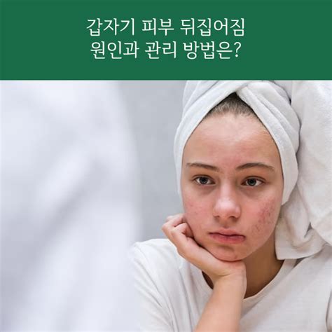갑자기 피부 뒤집어짐 원인과 관리 방법은 네이버 블로그