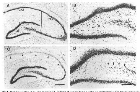 Figure 1 From Alterations In T Immunostaining In The Rat Hippocampus Following Transient