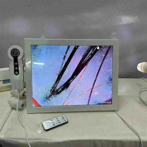 Professional Scalp Analyzer Discover Scalp Health Luxe Beauty And Body Co