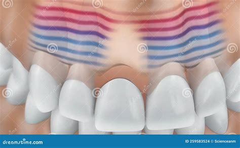 Pressure From The Lower Teeth To The Upper Teeth Stock Illustration