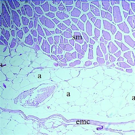Entrapped Muscle Cells By Well Differentiated Adipocytes A Adipocytes