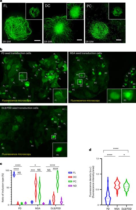Serum Iprt Quic Amplified α Synuclein Seeds From Participants With Pd Download Scientific
