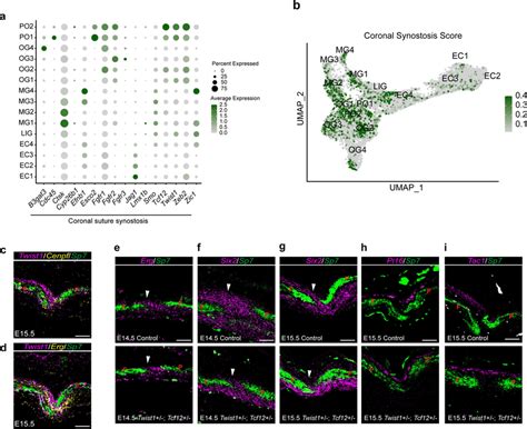 Enrichment And Requirements Of Coronal Synostosis Genes For Osteogenic
