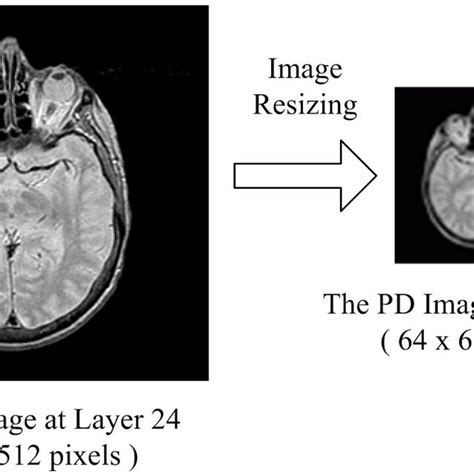 Image Resizing Process Download Scientific Diagram