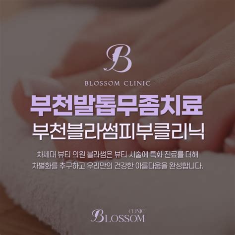부천발톱무좀치료 오니코레이저로 시원하게 해결해요 네이버 블로그