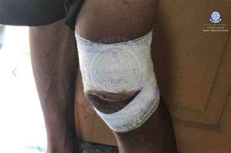 ကျိုက်ထိုမြို့နယ်ရှိ ကျေးရွာများကို စစ်တပ်က တိုက်ပွဲဖြစ်ပွားခြင်းမရှိဘဲ ဒရုန်းများဖြင့် ဗုံးကျဲ