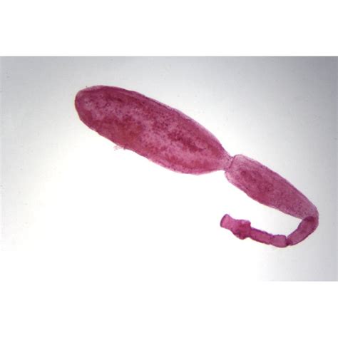 Echinococcus Granulosus Adult Wm Medical And Science Media