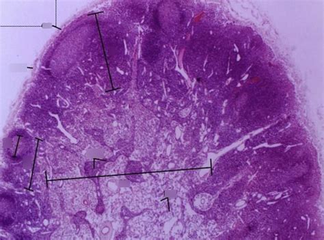 Structure Of The Lymph Node Diagram Quizlet