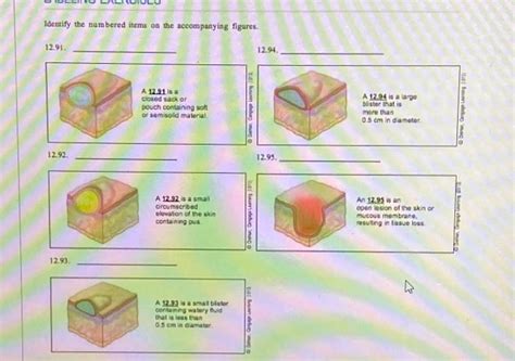 Solved Identify The Numbered Items On The Accompanying