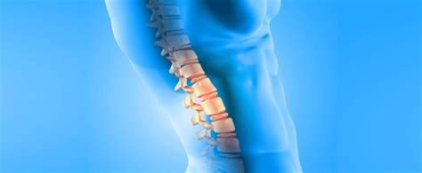 Slipped Discs Symptoms Causes And Treatments In Malaysia