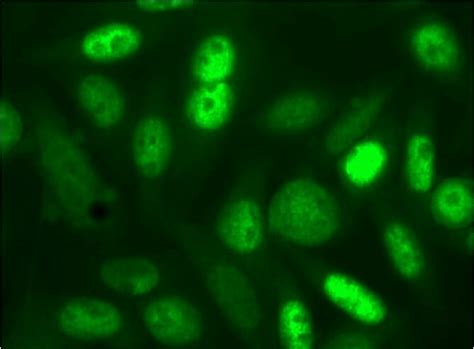 Anti Runx1 Antibody A 2 Scbt Santa Cruz Biotechnology