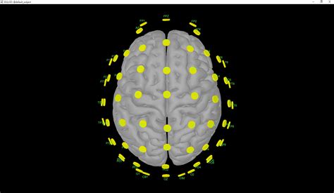 Source Localization Abnormality Eeg Reference Problem Discussions Brainstorm