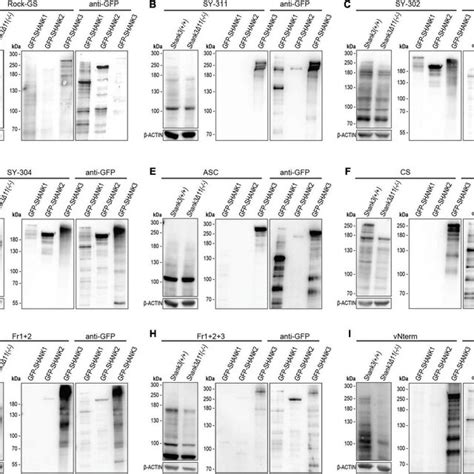 Ihc Analysis In Striatum Of Mouse Brain Sections A Sections Of Wt Download Scientific