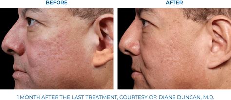 Skin Rejuvenation Shahla Medical Group