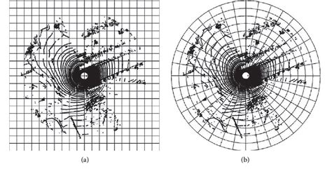 Figure 1 From Learning Deformable Network For 3d Object Detection On Point Clouds Semantic Scholar