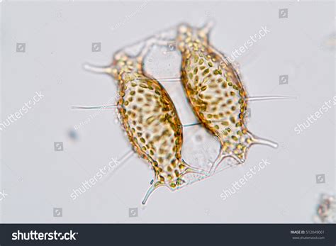 Dinophysisdinoflagellate Marine Protozoa Under Microscope ภาพสต็อก 512049061 Shutterstock
