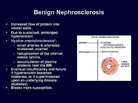 Renal Pathology Greg Balko Md May 27