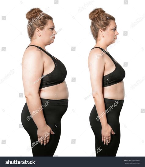 Before After Weight Loss Women