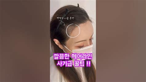 잔머리펌 헤어라인 만들기 헤어라인교정 잔머리펌 잔머리컷 장원영 엠자이마 엠자탈모 레이어드c컬펌 레이어드컷 Youtube