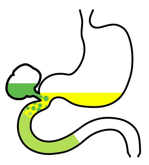 Two Stage Biorelevant Dissolution Transfer Test