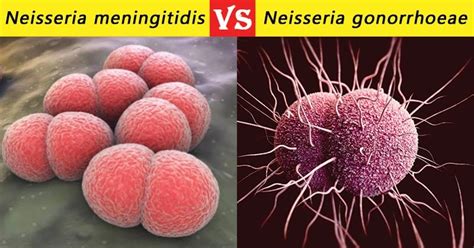Neisseria Meningitidis Vs Neisseria Gonorrhoeae 32 Differences