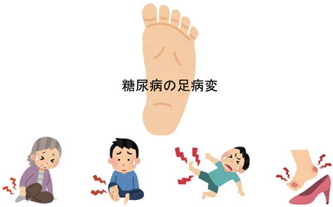 糖尿病の神経障害の症状とは？原因や検査、治療についても解説