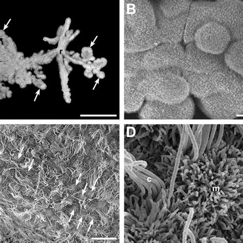 Scanning Electron Microscopy Of Choroid Plexus At Low Vacuum AD Download Scientific Diagram