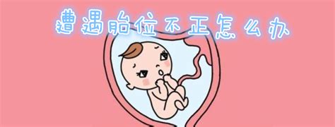 胎位不正做纠正操有用吗 做胎位纠正注意事项 八宝网