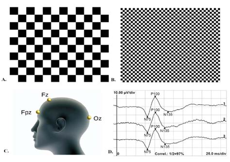 Visual Evoked Potentials Recording Protocol A Stimulus Pattern For Download Scientific