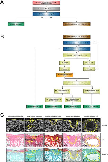 micro ct based algorithm for the analysis of the subchondral bone