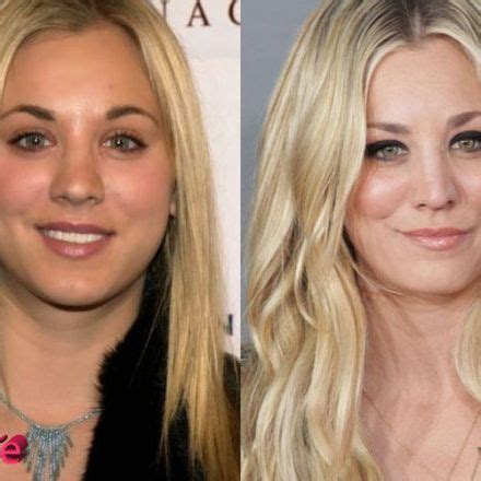 Kaley Cuoco Before And After Plastic Surgery