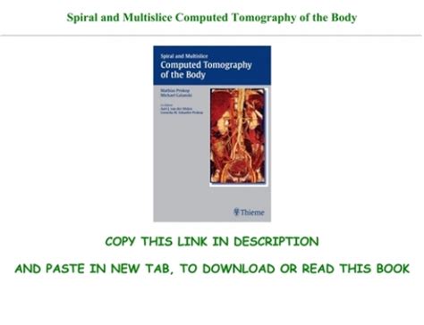 ~read Book Spiral And Multislice Computed Tomography Of The Body Full