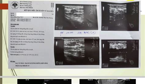 Vietnamese Medic Ultrasound Case 716 Sister Mary Joseph Nodule And