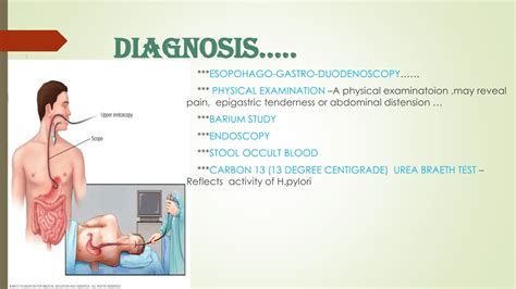 Ppt Peptic Ulcer Disease Meaning Causes Ppi Iv Infusions Management For Nurses Powerpoint