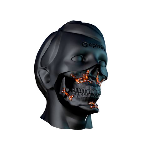 Ortognática Cpmh Digital