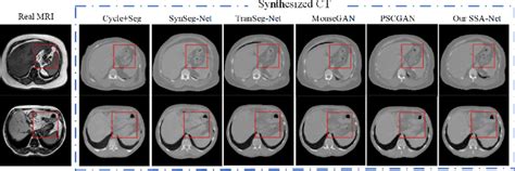 Figure From Attention Based Cross Domain Synthesis And Segmentation From Unpaired Medical
