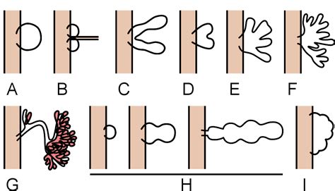 Fileroot Nodule Morphologiessvg Wikimedia Commons