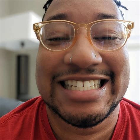 18 Month Brace Journey Is Over R Braces