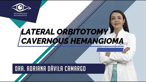 Lateral Orbitotomy Without Osteotomy Cavernous Hemangioma Youtube