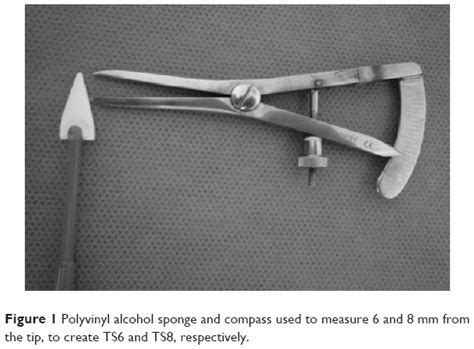 In Vitro Mitomycin C Absorption And Delivery With Different Sponge Mat