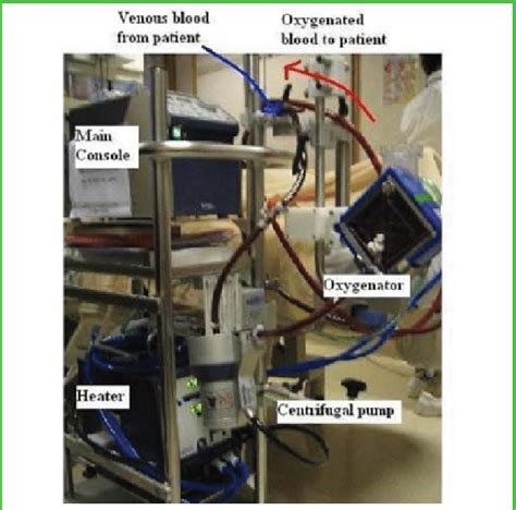 Different Components Of An Ecmo System The Main Console Controls The Download Scientific